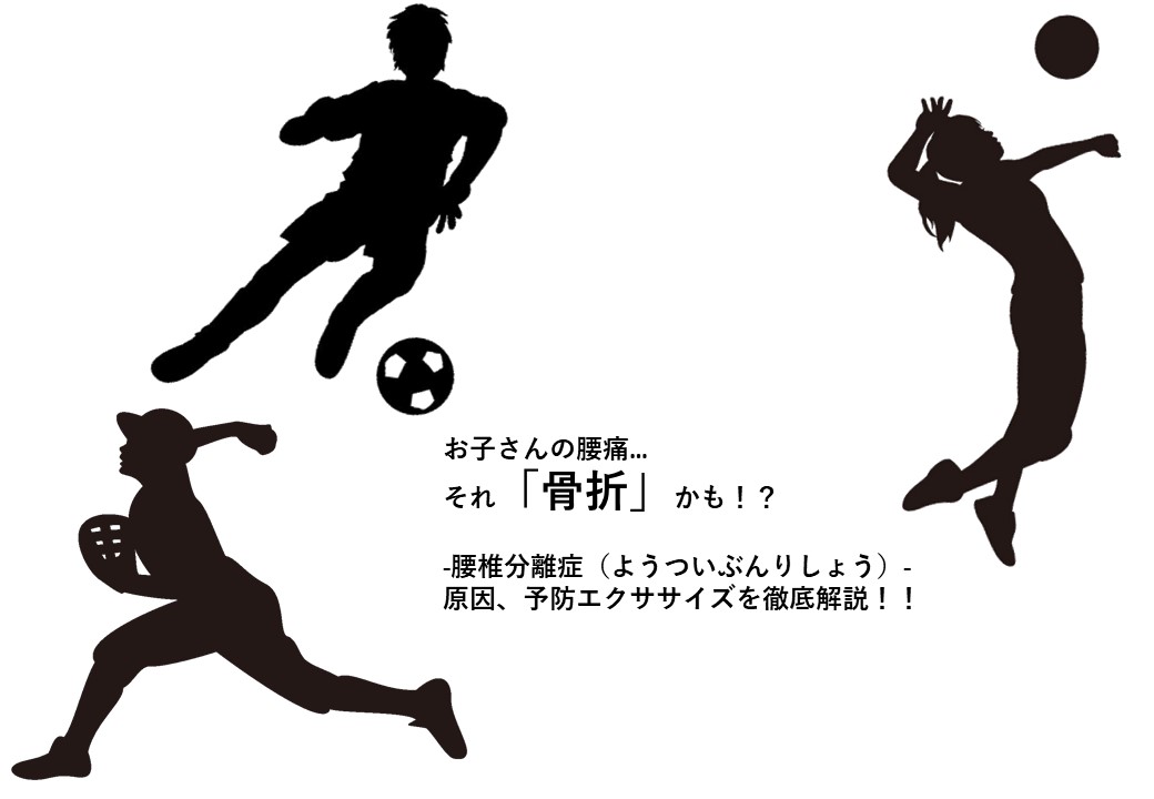 子どもの腰痛は骨折かも⁉︎ | 腰椎分離症を徹底解説 | joyplus